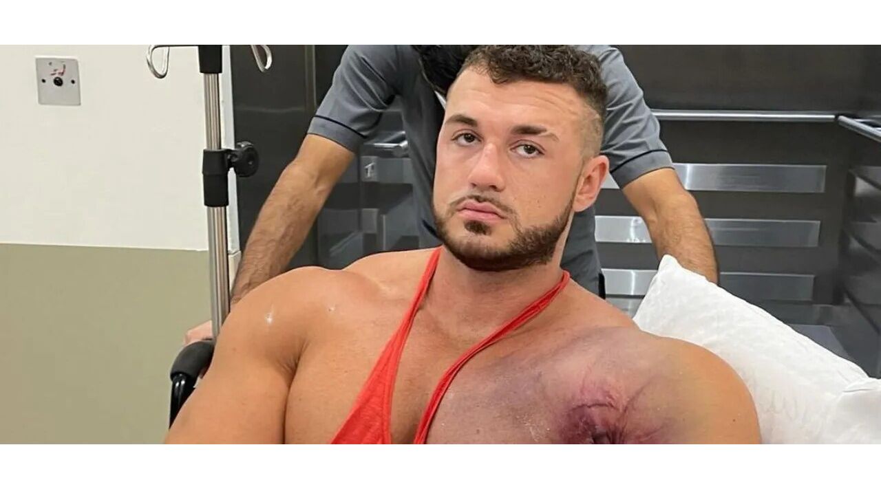 Ryan Crowley loopt erge blessure op tijdens bankdrukken